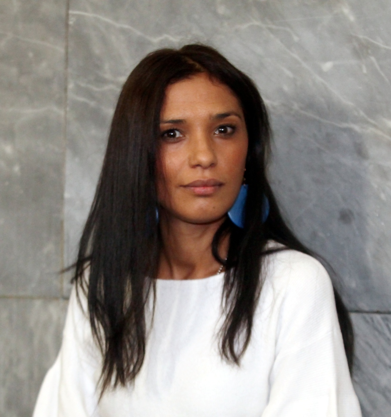 Imane Fadil giunta in ospedale con grave patologia al midollo